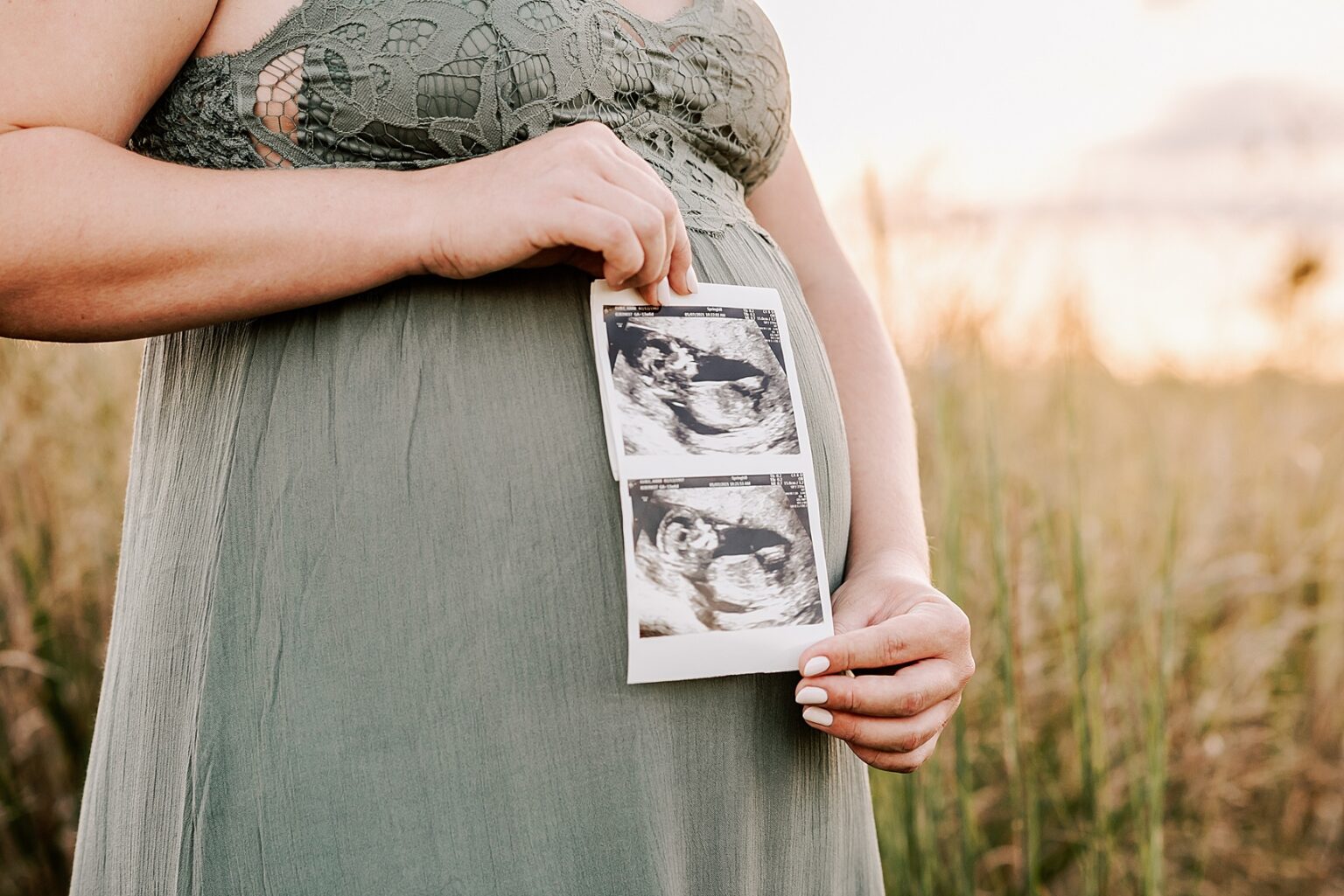Expert OBGYN Care at Wake Forest OBGYN Shepherd Street